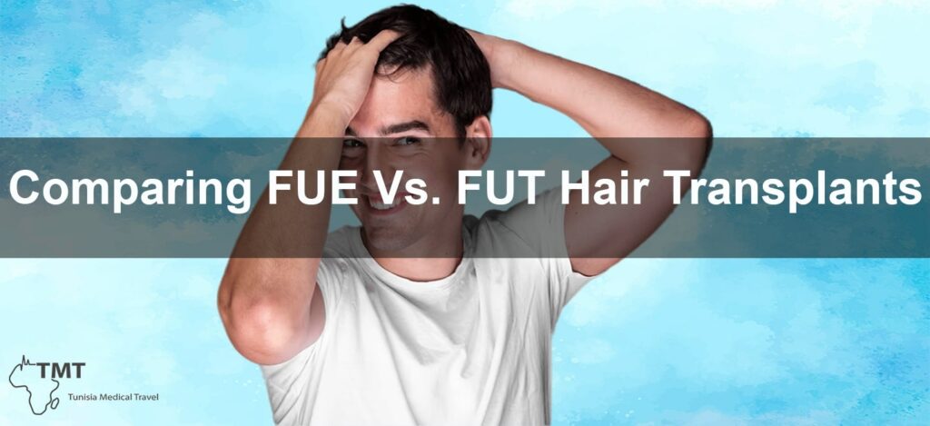 FUE vs. FUT : A Comprehensive Comparison Guide