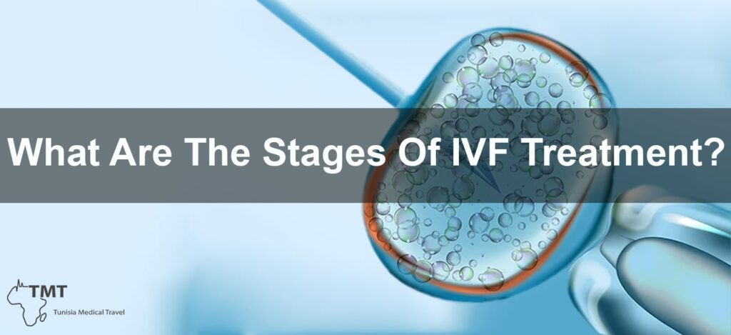 In Vitro Fertilization (IVF): A Comprehensive Guide