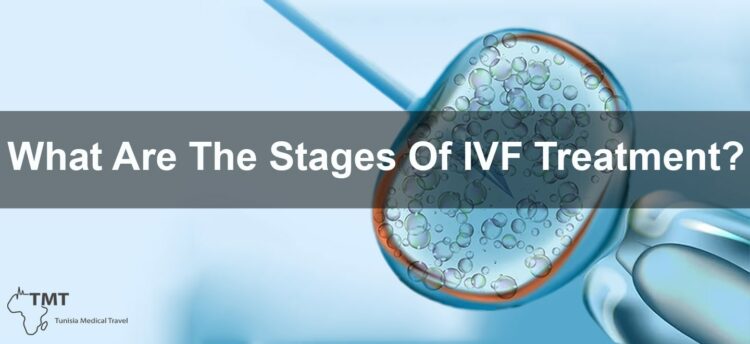 In Vitro Fertilization (IVF): A Comprehensive Guide